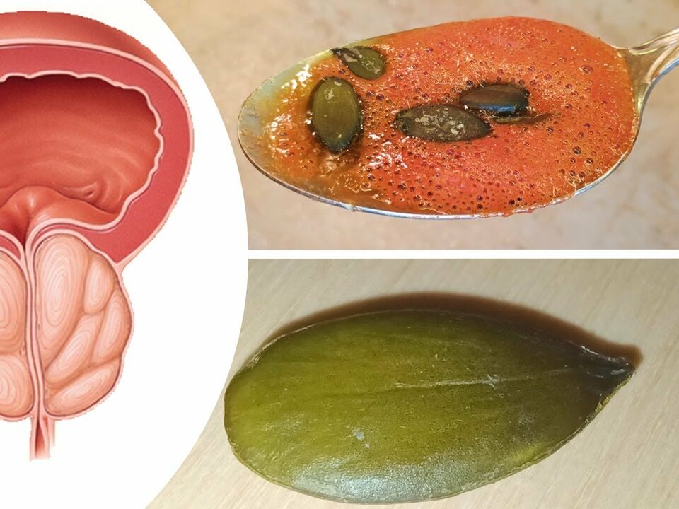 First Aid for Prostate Health: Recovery with Powerful Lycopene and ...