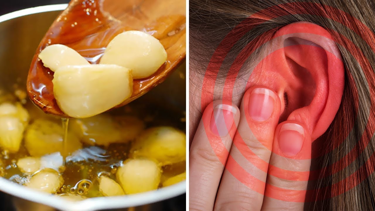 How to Make Garlic Oil Ear Drops for Ear Infections and Ear Aches ...