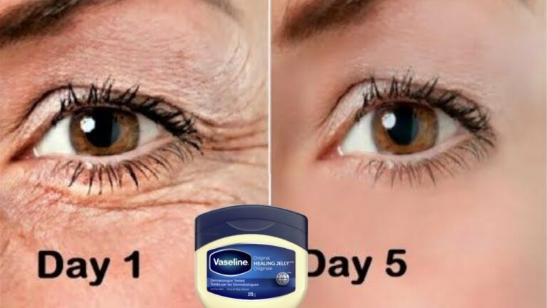 The Power of Vaseline to Remove Wrinkles! Look 20 Years Younger Naturally