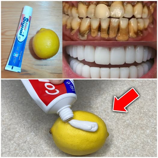 Brighten Your Smile! Remove Yellow Teeth with This Simple Toothpaste ...