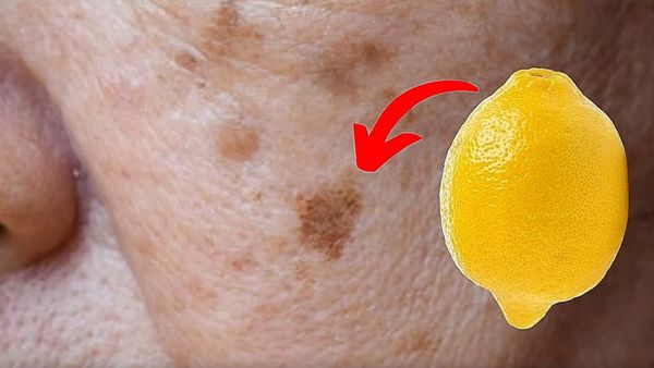 How to Fade Age Spots with Lemons! 🍋🌞 – Green Tricks