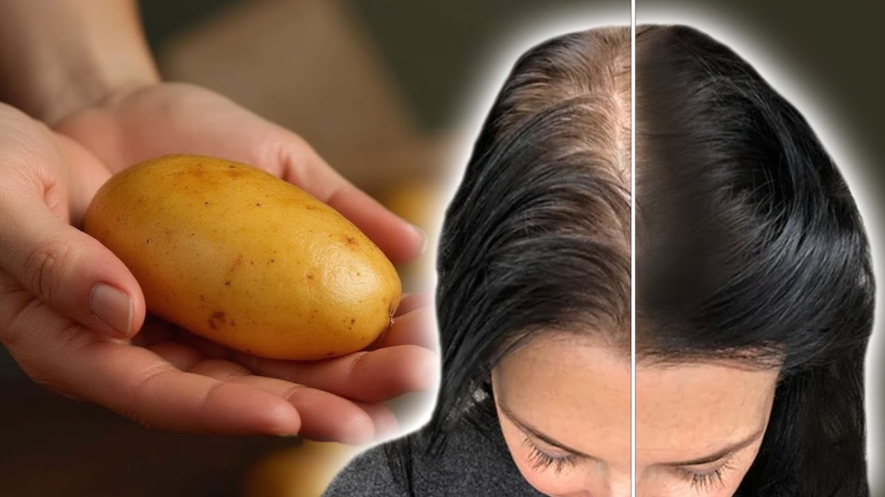 🥔 Hair Grows Like Crazy and Doesn’t Fall Out! | The Most Effective ...