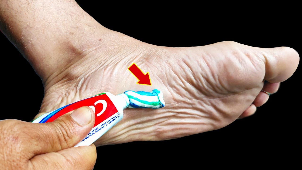 I Would Die and Not Know This! Put Toothpaste on Your Feet and Never ...