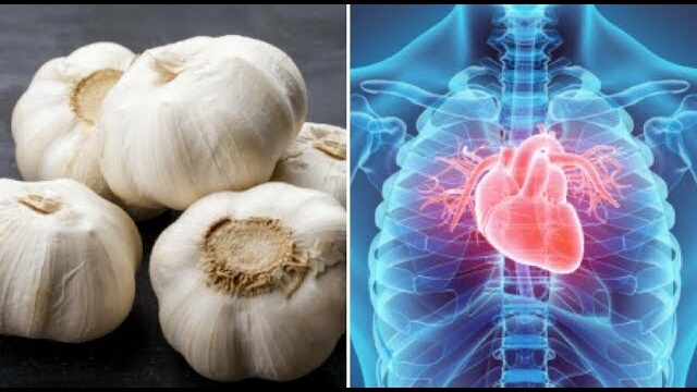 5 Miracle Cures of Garlic That Will Surprise You – Powerful Benefits ...