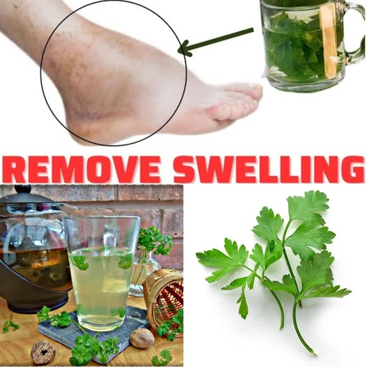 How Parsley Tea Quickly Removes Swelling in Legs and Feet – Green Tricks